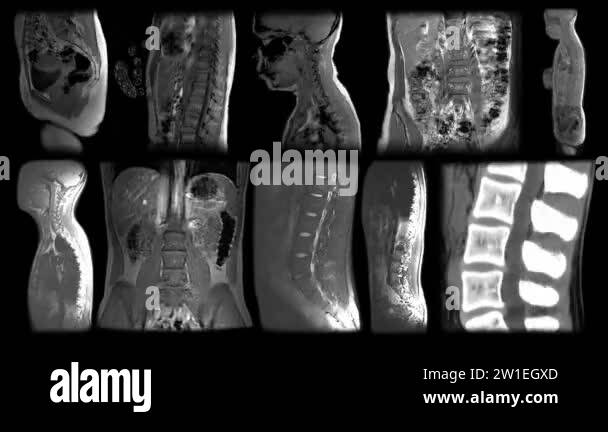 MRI scan timelapse of various sides human body, spine, bones organs ...