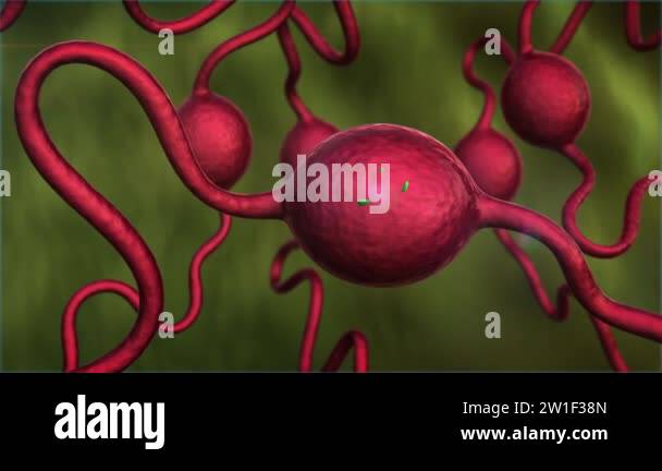 tumor on the human gland, fungal infection and human gland, development ...