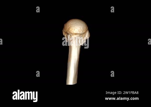 Head of humerus bone Stock Videos & Footage - HD and 4K Video Clips - Alamy