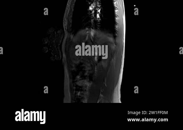 MRI scan timelapse of various sides human body, spine, bones organs ...