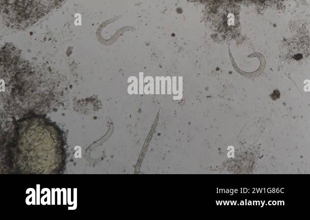 parasite : Strongyloides stercoralis from human feces under microscope ...