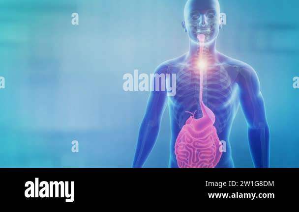 Bacteria infection spreading throughout different human organs. Germs ...