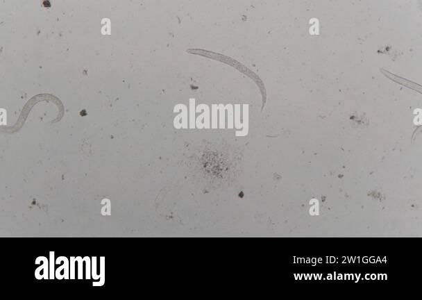 parasite : Strongyloides stercoralis from human feces under microscope ...