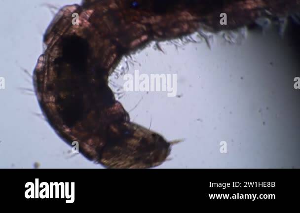 Mosquito larva under microscopy Stock Videos & Footage - HD and 4K ...