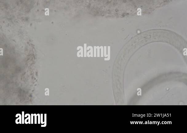 parasite : Strongyloides stercoralis from human feces under microscope ...