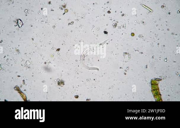 Many bacteria Stock Videos & Footage - HD and 4K Video Clips - Alamy