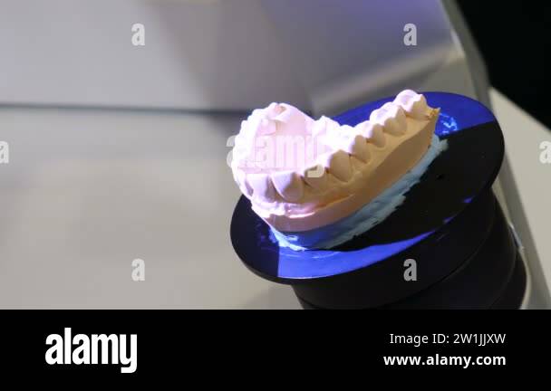 Dental prosthetic restoration. Bright laser moving on surface of gypsum ...