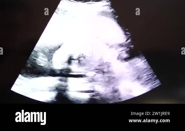 Baby scan Stock Videos & Footage - HD and 4K Video Clips - Alamy