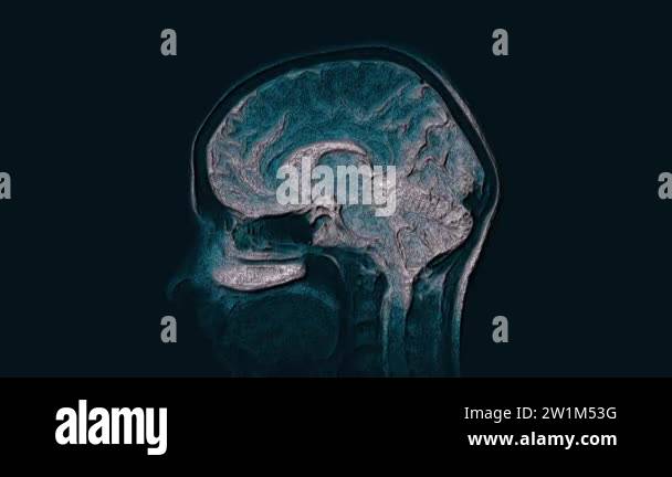 Voluminous color MRI brain, head scans and tumor detection. Diagnostic ...
