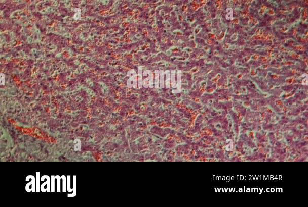 Liver of the hedgehog in cross section under the microscope 100x Stock ...