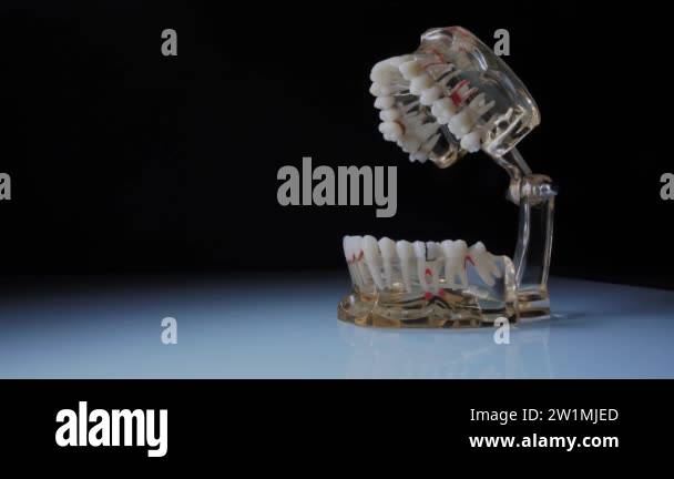 Close - up of teeth with examples of defects and bad teeth Stock Video ...