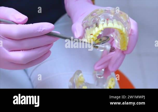 Dentist Shows the Patient on the Model of the Jaw How to Properly Treat ...