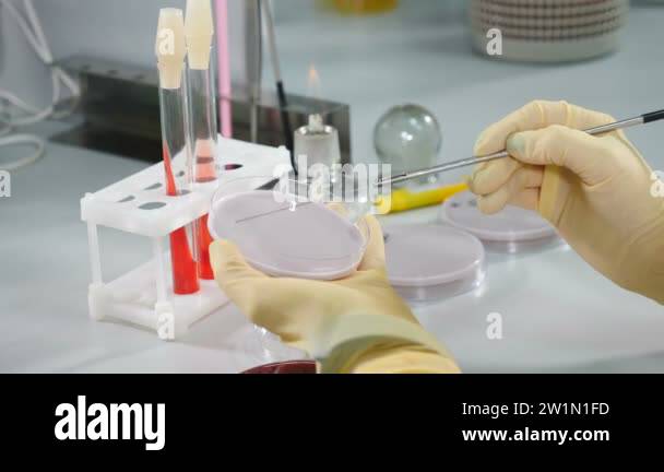 Bacteriological crops of various bacteria and microorganisms are ...