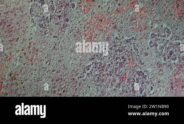 Liver poisoning after consumption of the death cap mushroom in cross ...