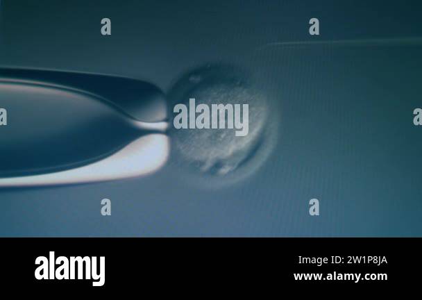 Cells moving under microscope. Ivf, In Vitro Fertilisation concept ...