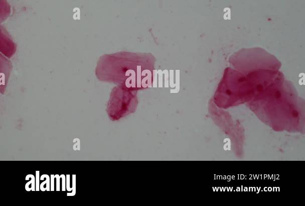cells of the oral mucosa with cell nucleus and bacteria at high ...