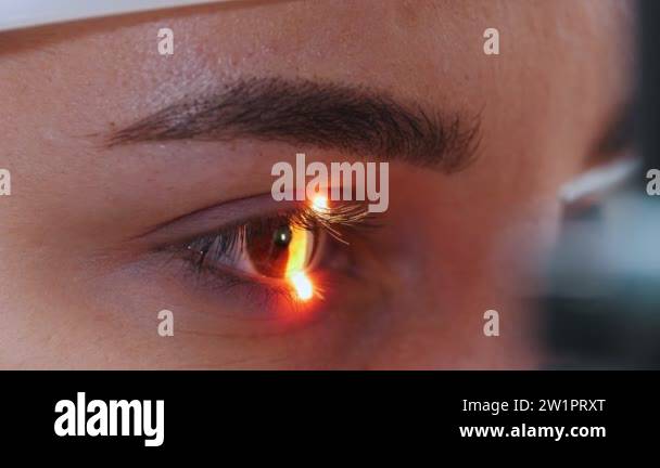 Eyes eye test visual acuity Stock Videos & Footage - HD and 4K Video ...