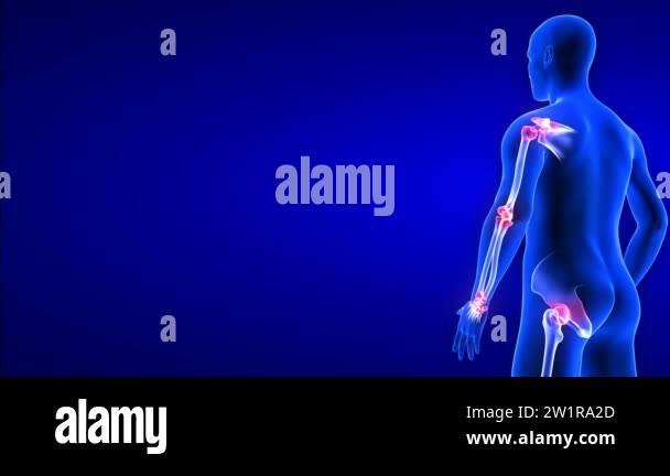 Joint Pain animation from side view - close-up. Blue Human Anatomy Body ...