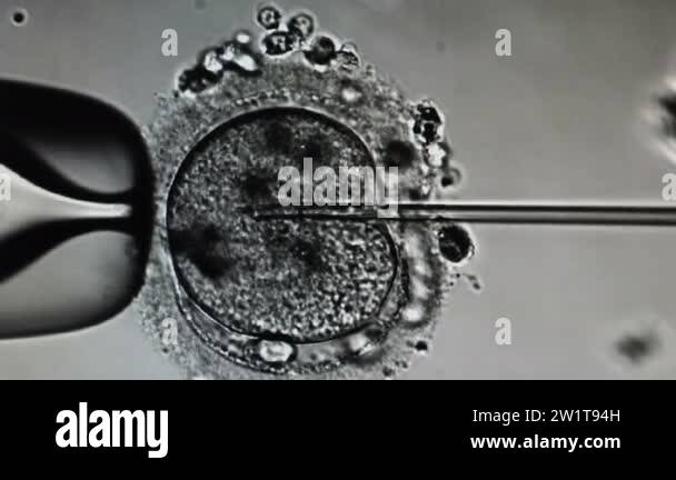 Icsi in vitro fertilization Stock Videos & Footage - HD and 4K Video ...