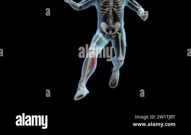 Achilles tendon anatomy Stock Videos & Footage - HD and 4K Video Clips ...