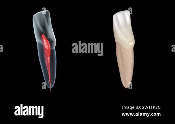 Dental root anatomy - Central maxillary incisor tooth. Medically ...