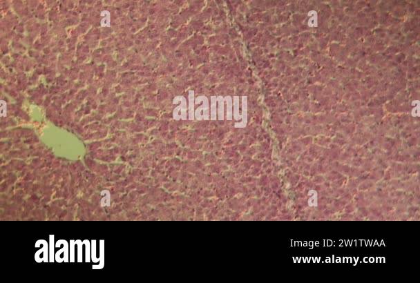 Pig liver anatomy Stock Videos & Footage - HD and 4K Video Clips - Alamy