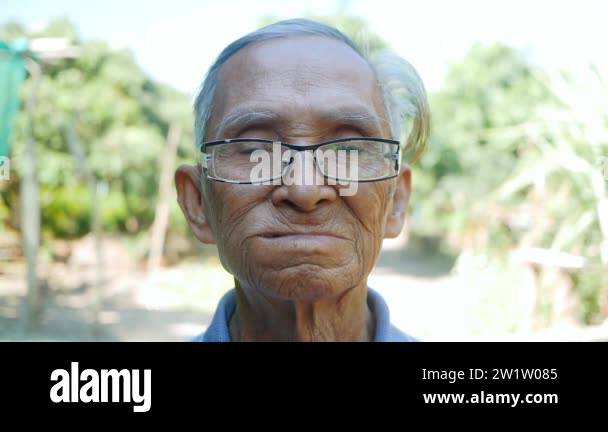 Elderly man biting on cotton gauze after tooth extraction, Tooth decay ...