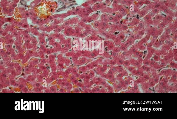 Parasites anatomy Stock Videos & Footage - HD and 4K Video Clips - Alamy