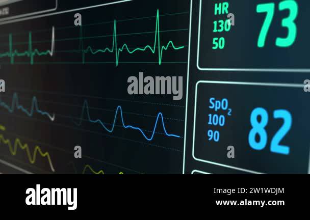 Heart beat rate ECG cardio monitor in hospital. Heartbeat display ...