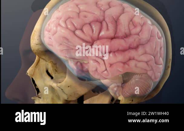 Cerebrospinal fluid, clear, colorless body fluid in the brain and ...