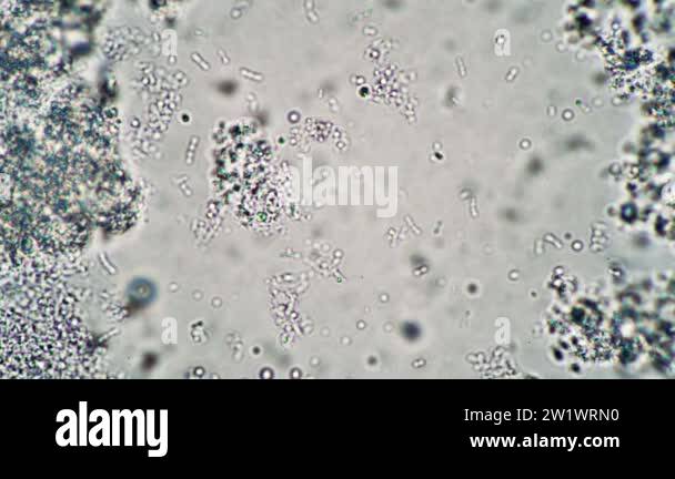 Microscopic milk bacilli float in the leaven in the microscope Stock ...