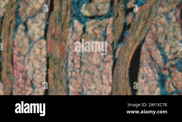 Monkey tongue with papillae at high magnification in darkfield under ...