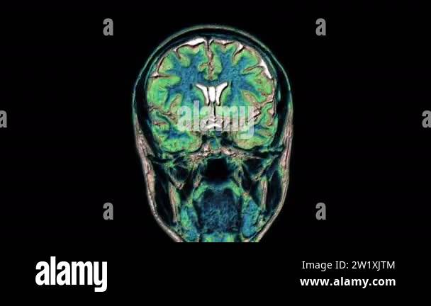 Bulk multicolored MRI scans of the brain and head to detect tumors ...