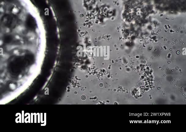 Coli and Bacillus in the starter culture for milk under the microscope ...