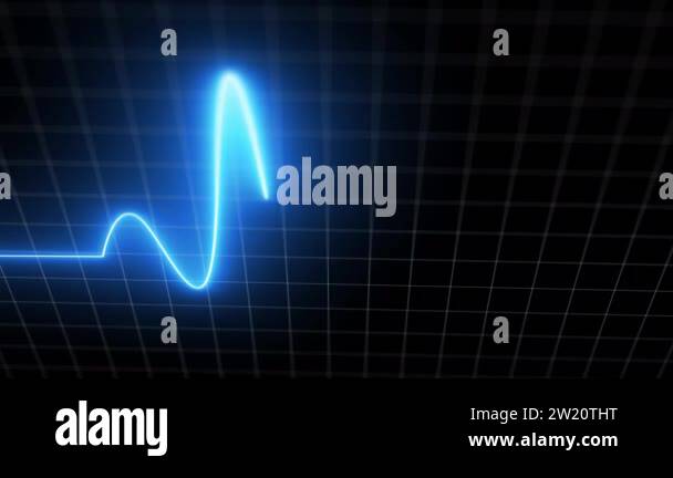 Blue heartbeat monitor EKG line monitor with moving camera processing ...