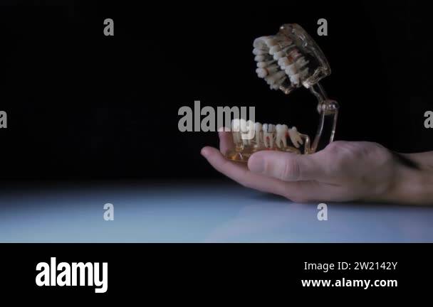 Close - up of teeth with examples of defects and bad teeth Stock Video ...