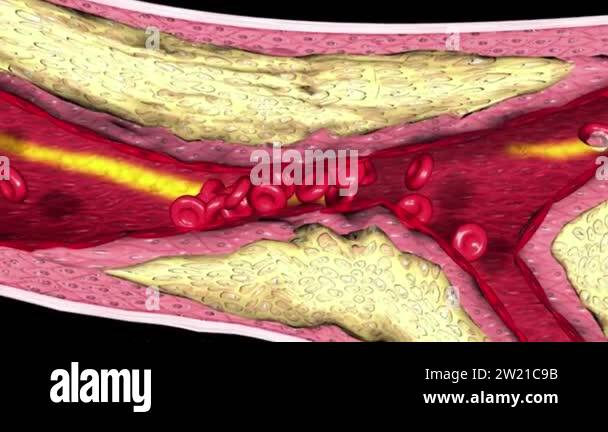 Circulatory system heart blood Stock Videos & Footage - HD and 4K Video ...