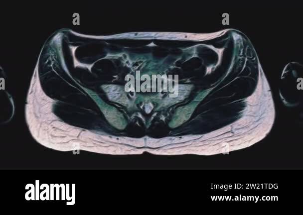 Bulk multicolored MRI of the female pelvic organs, abdominal cavity ...