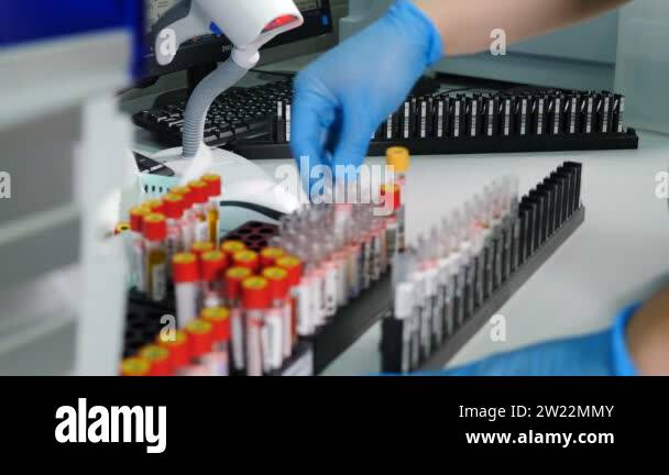 Medicine blood samples test tubes Stock Videos & Footage - HD and 4K ...