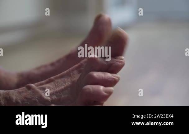 Sick elderly leg. Senior leg problems. Legs old woman with crippled ...