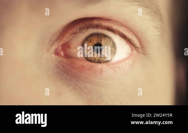 Wide open eye. Constriction of the pupil. Man with green eyes looks ...