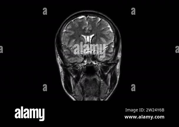 Voluminous MRI scans of the brain and head to detect tumors. Diagnostic ...