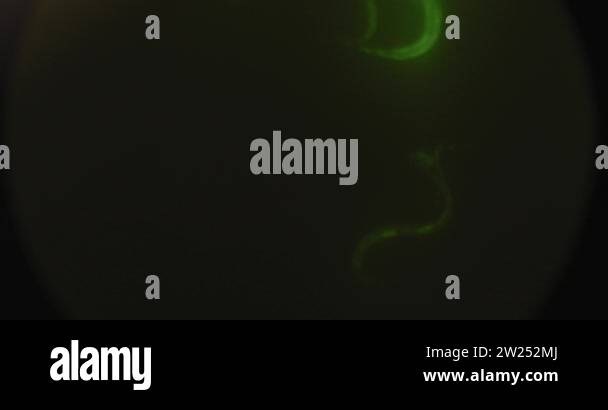 Highlighted green microorganisms, c-elegans (Caenorhabditis elegans) nematode worms under the ...