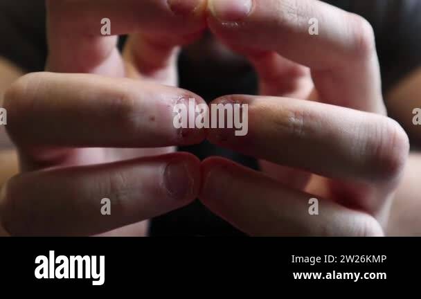 Close view of male hands with strongly bitten nails. Finger selection ...