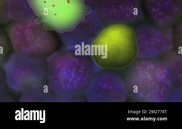 Cytotoxic T cell is a T lymphocyte that kills cancer cells, cells that ...