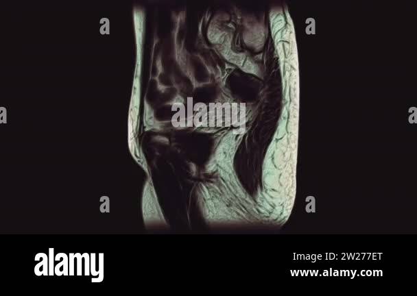 Bulk multicolored MRI of the female pelvic organs, abdominal cavity ...