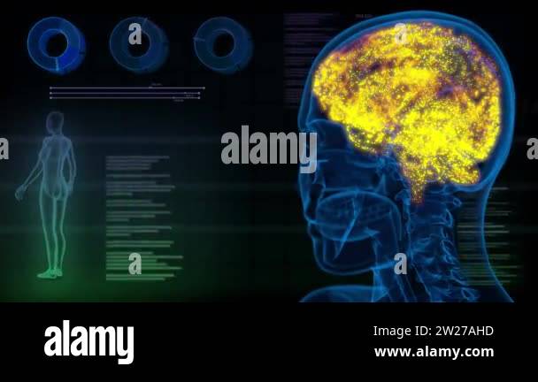Neuroscience - concept of mental neural impulses in human brain, mentsl ...