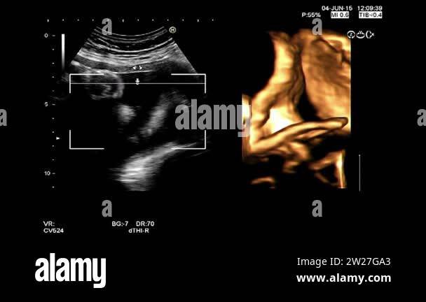 4D high quality ultrasound echography check. Gynecological medical ...