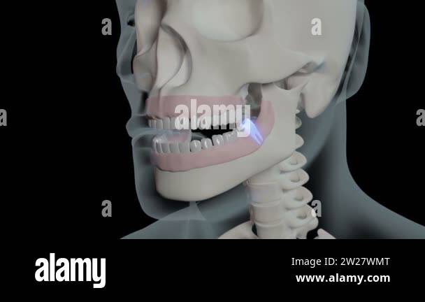 Inflammation tooth Stock Videos & Footage - HD and 4K Video Clips - Alamy