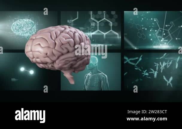 Animation of 3d pink human brain rotating in front of magnetic resonance imaging scan screens ...